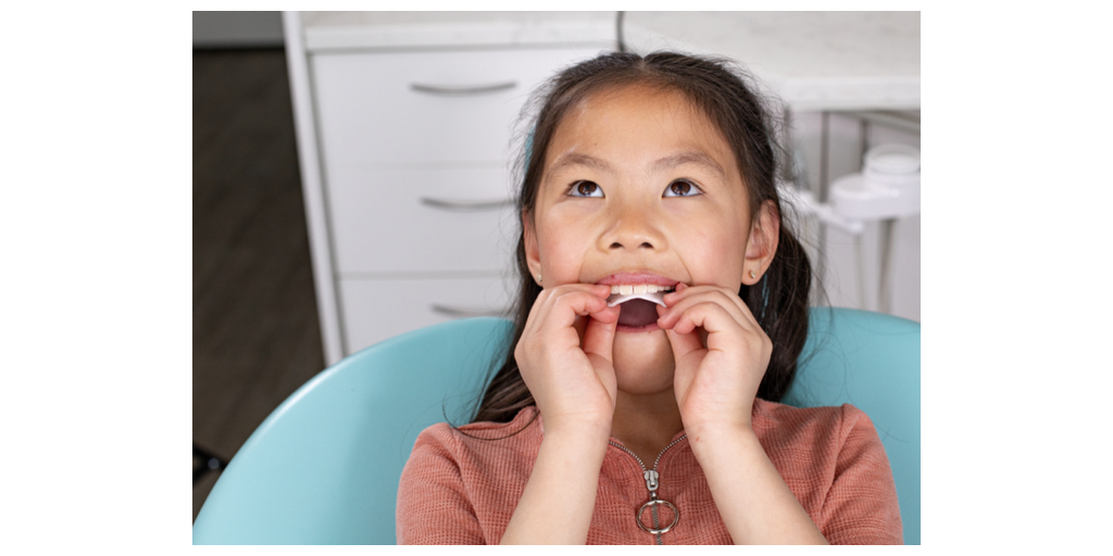Align Technology Introduces The Invisalign® Palatal Expander System To Address Skeletal